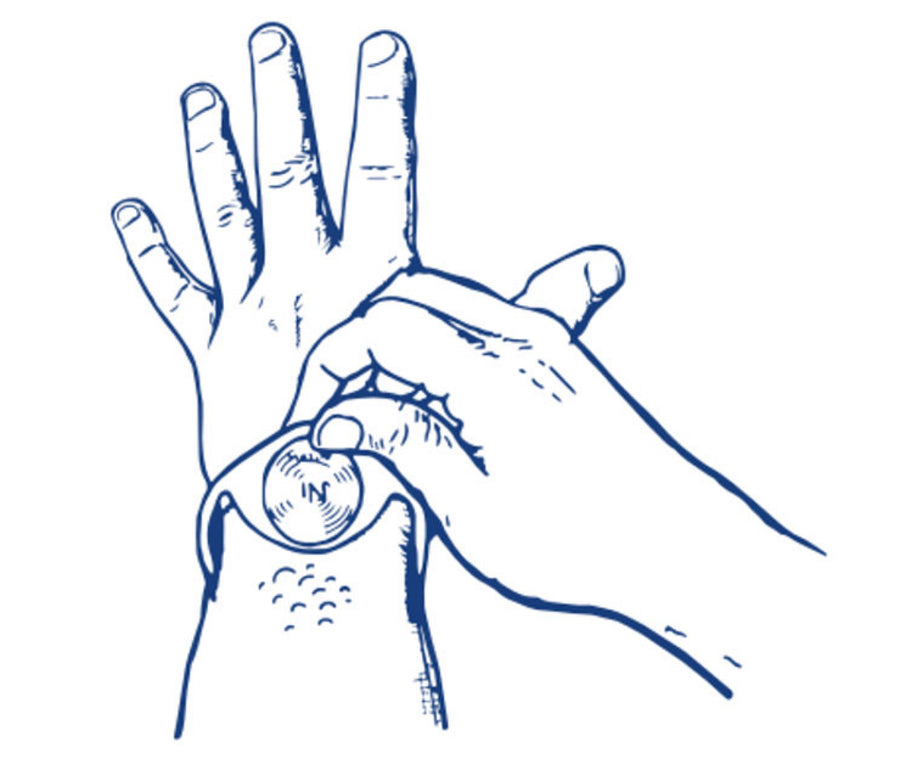 Sensiband Metal Allergy Test Kit