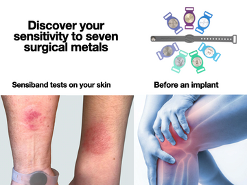 Sensiband Metal Allergy Test Kit